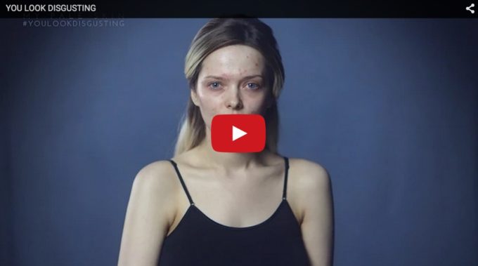 Millions of People Have Commented on Her Acne #YouLookDisgusting - 5 ...